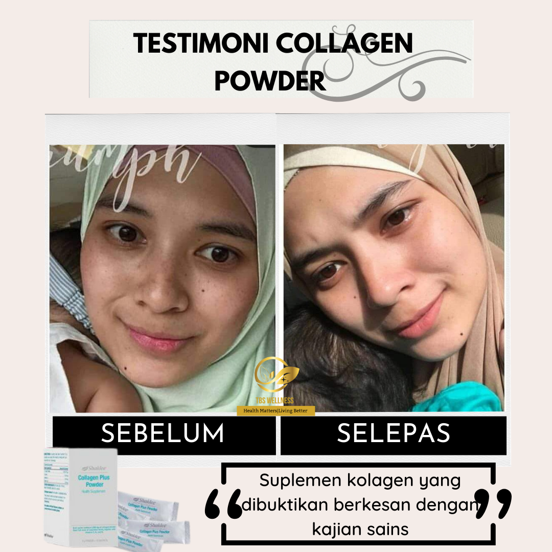 Testimoni Collagen Plus Powder Shaklee | Nina Salleh